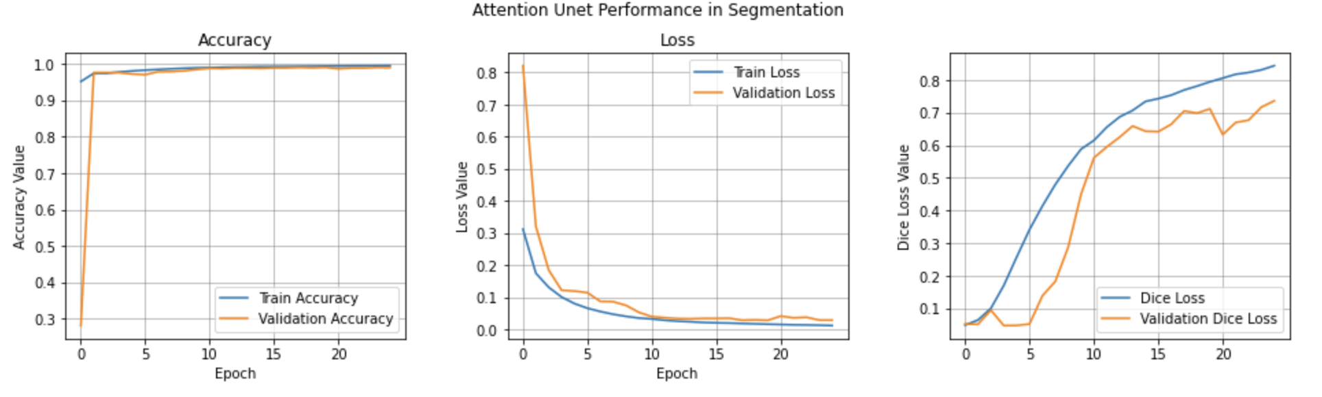 GitHub - YagmurTech/unet-brain-tumor-transfer-learning