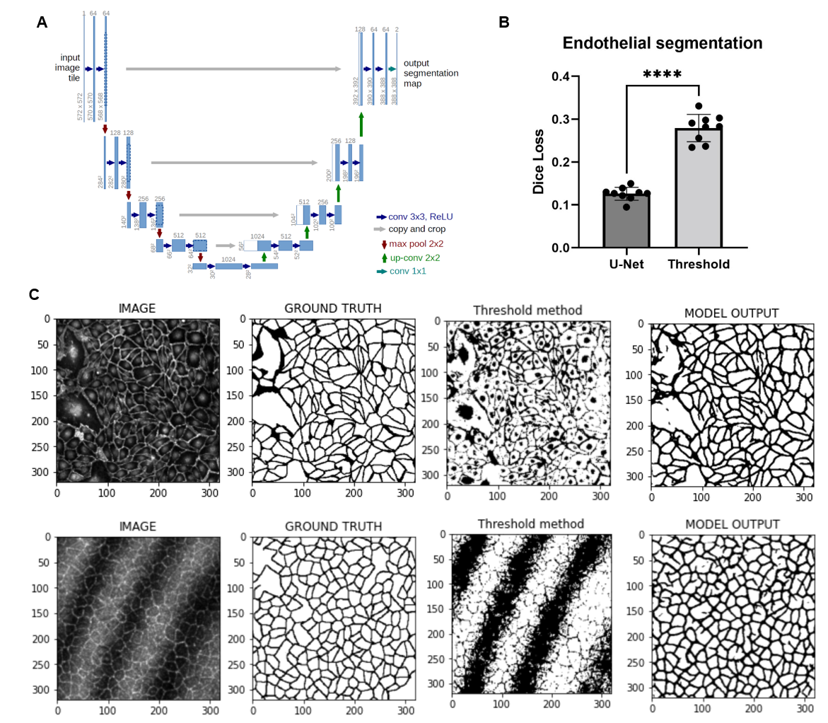 GitHub - lurenhaothu/U-Net-Endothelium-segmentation: Segmenting confocal images using U-Net