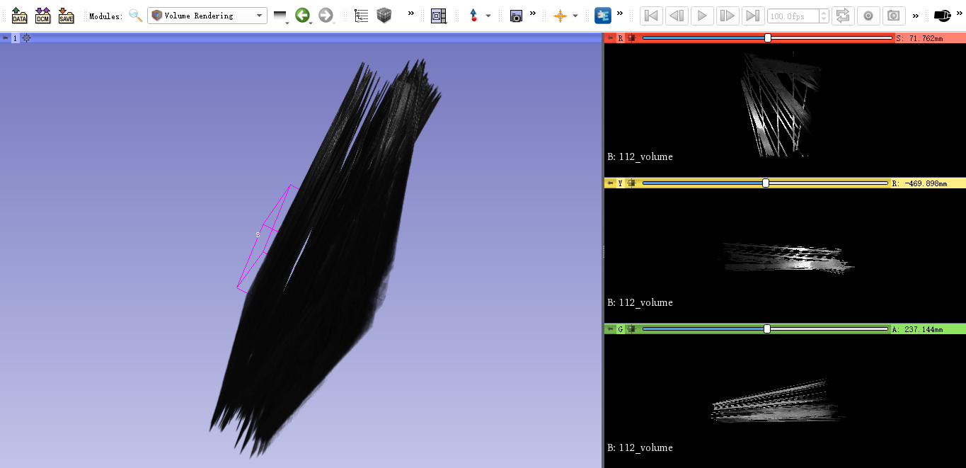 volume reconstruction · Issue #562 · PlusToolkit/PlusLib · GitHub