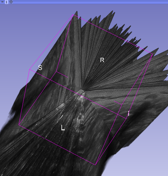 volume reconstraction result is error · Issue #568 · PlusToolkit/PlusLib · GitHub