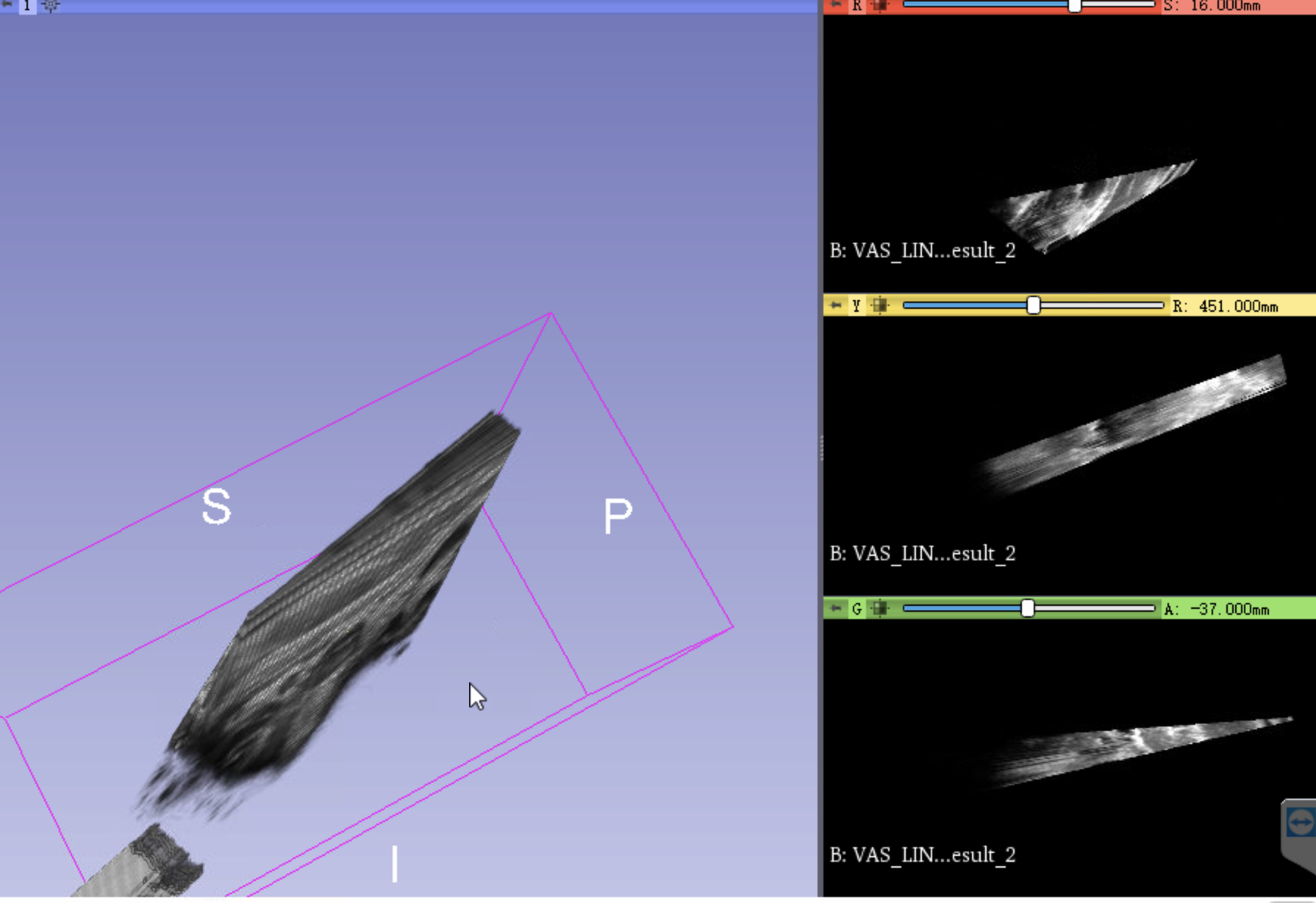 volume reconstruction error, need help · Issue #681 · PlusToolkit/PlusLib · GitHub