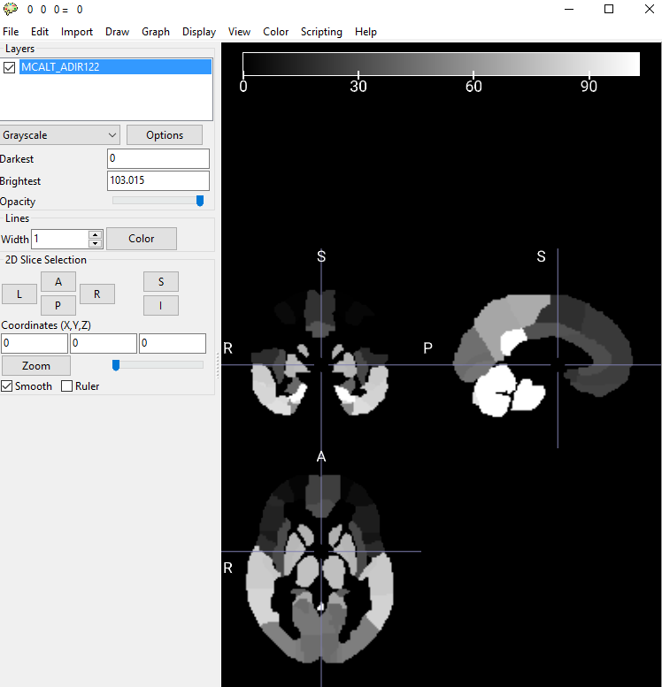 Nifti Image loading fails if the file path contains /atlases/ · Issue #7 · rordenlab/MRIcroGL ...