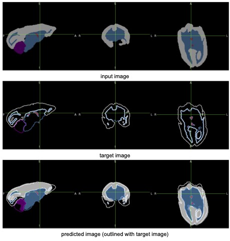 "ValueError: axes don't match array" in sample_segmentation_pairs_d.py · Issue #45 · BBillot ...