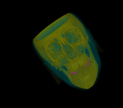 GitHub - jiayaozhang/volumerendering