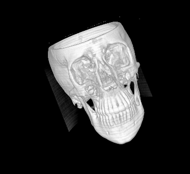 GitHub - jiayaozhang/volumerendering