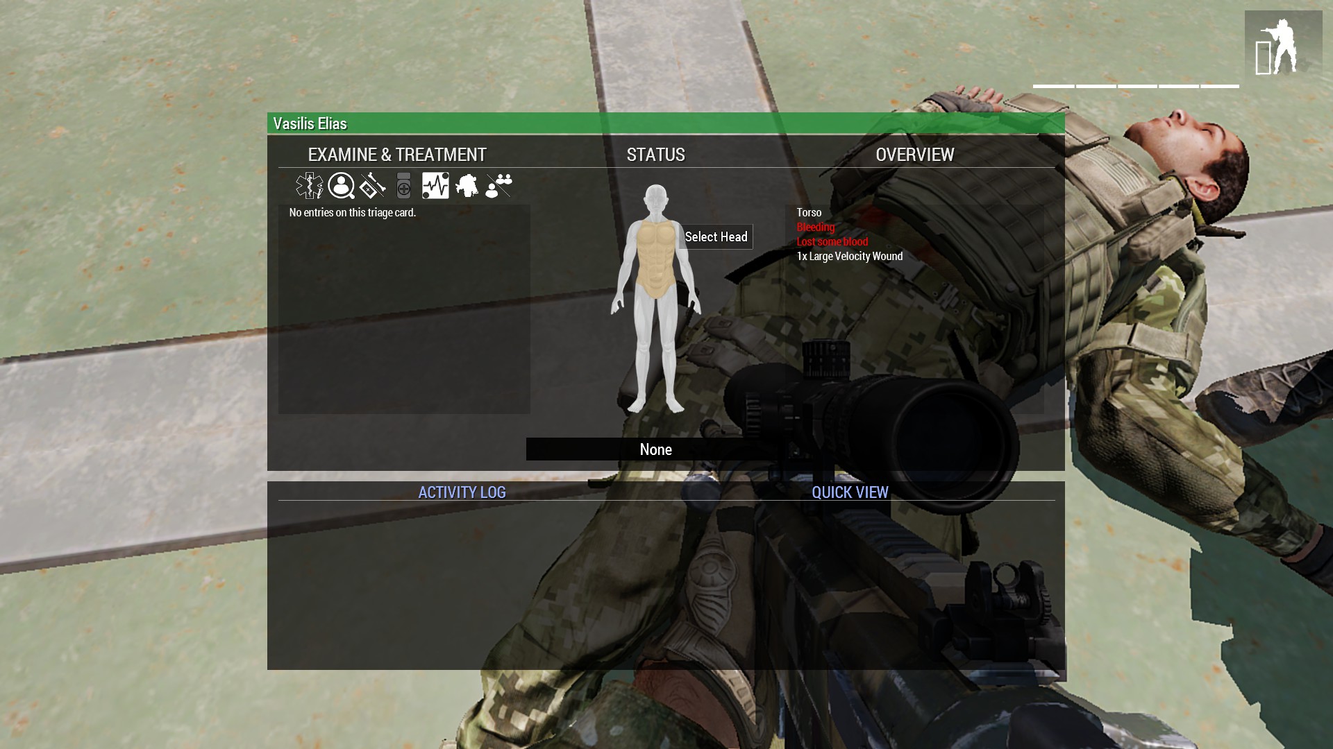 The Carrier Special Rig and Carrier GL Rig seemingly have swapped ...