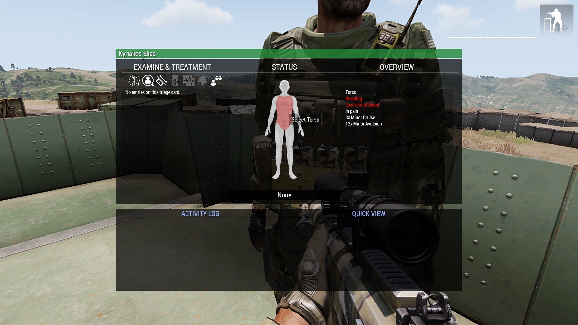 The Carrier Special Rig and Carrier GL Rig seemingly have swapped ...