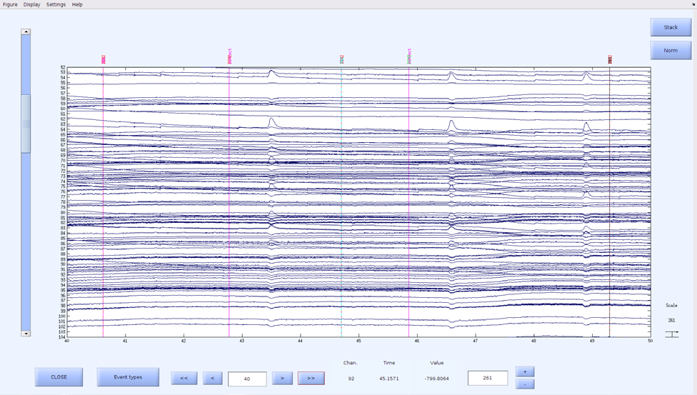 Eeg Processing Gui Manual Katielavigne Eeg Processinggui Github Wiki