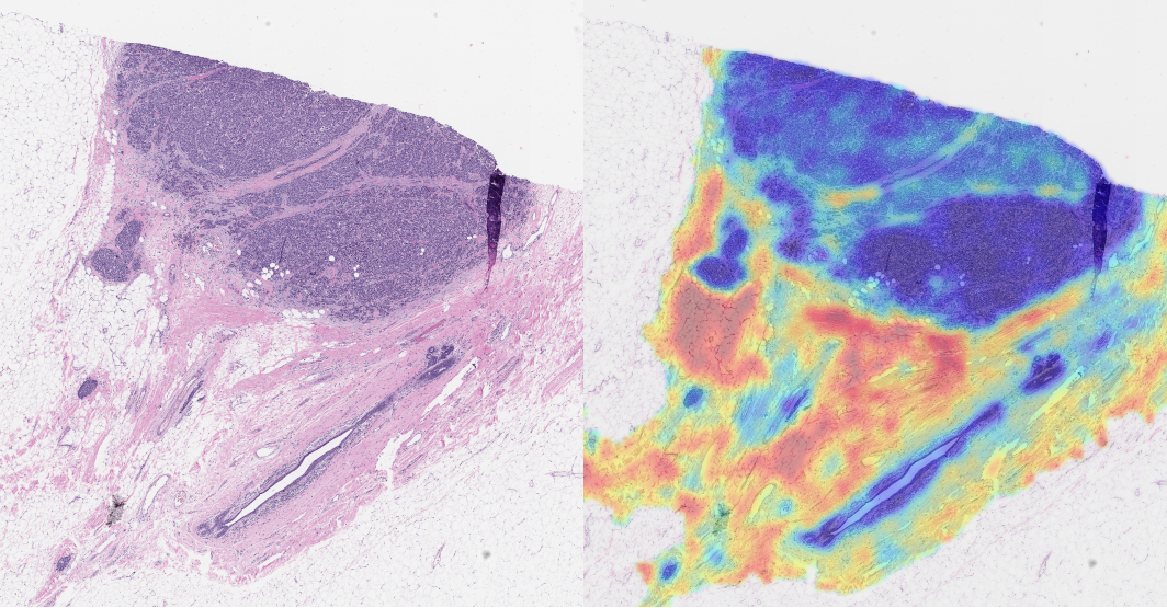 Heatmap interpretation problem · Issue #63 · mahmoodlab/CLAM · GitHub