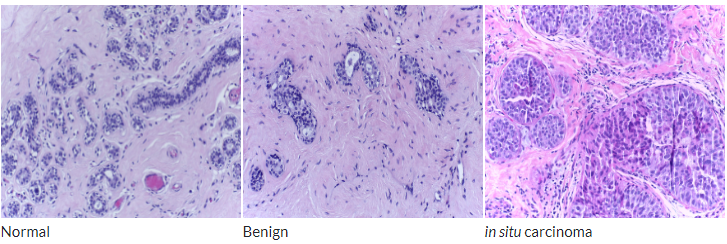 Patching on microscopy images · Issue #72 · mahmoodlab/CLAM · GitHub