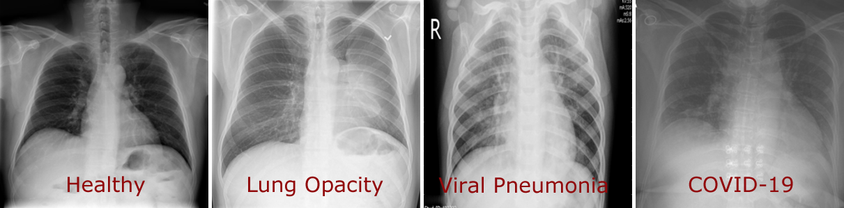GitHub - Sijma/ai-xray-classification: Machine Learning for COVID-19 Radiography Diagnosis using ...