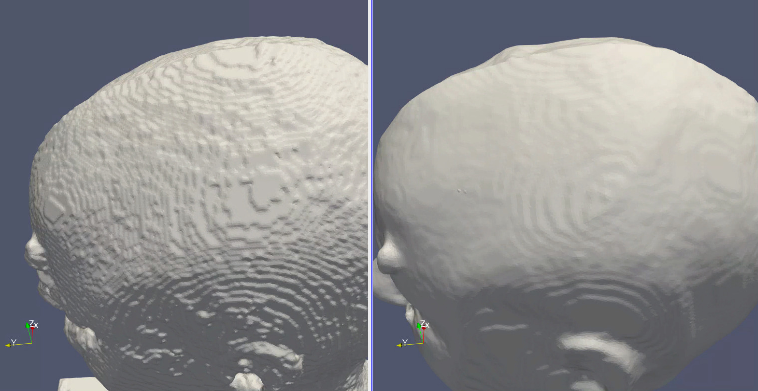 headreco: Uneven surface leads to weird TMS coil positions · Issue #42 · simnibs/simnibs · GitHub