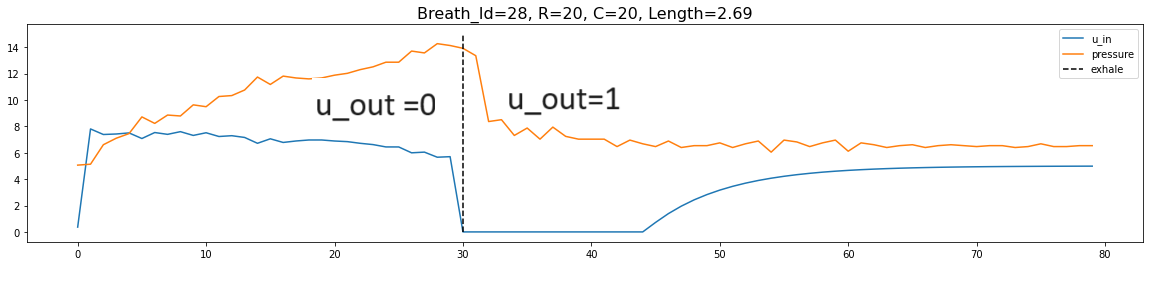 GitHub - Guillaume2126/Mechanical-Ventilation-Prediction-Back-end: Le wagon - group project