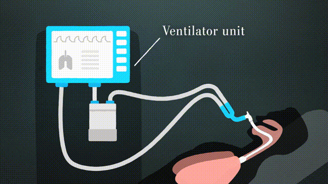 GitHub - Guillaume2126/Mechanical-Ventilation-Prediction-Back-end: Le wagon - group project