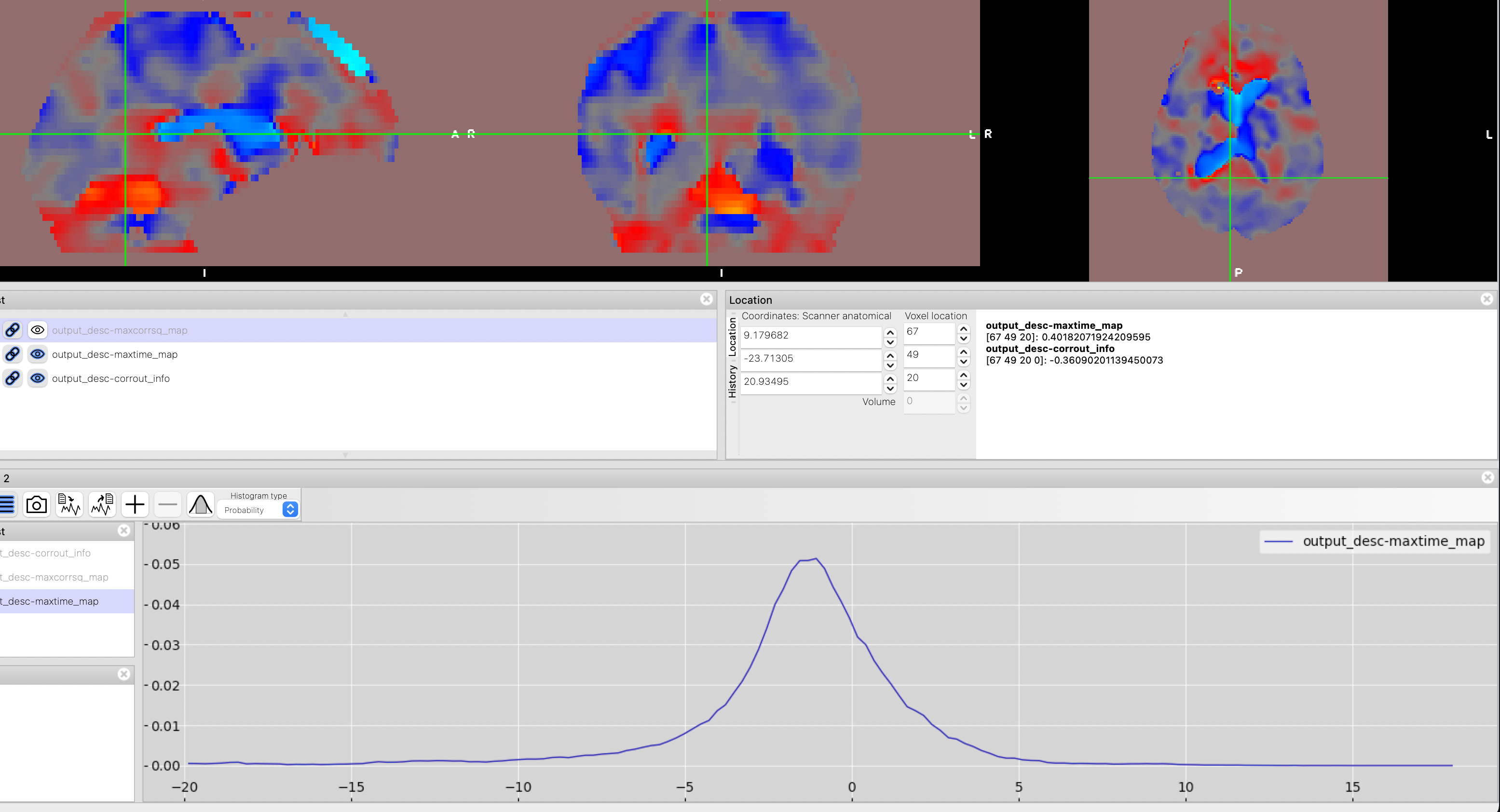 -d/dt fMRI signal for BOLD-CSF inflow coupling analysis · Issue #67 · bbfrederick/rapidtide · GitHub