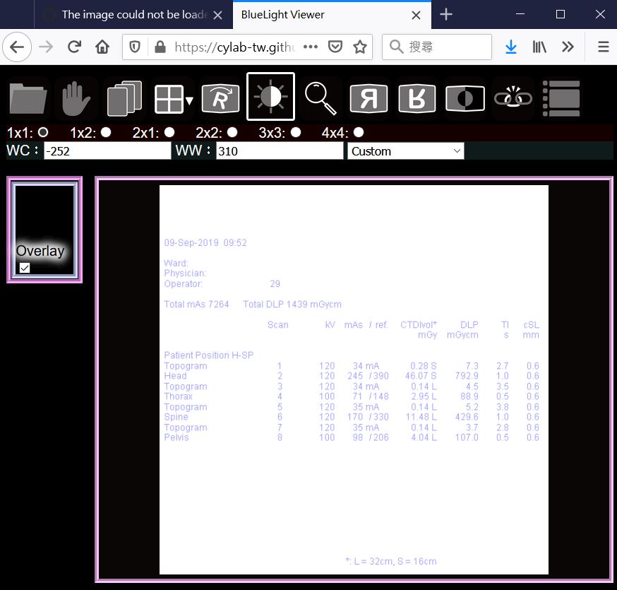 The Image Could Not Be Loaded Successfully · Issue 481 · Cornerstonejs Cornerstone · Github