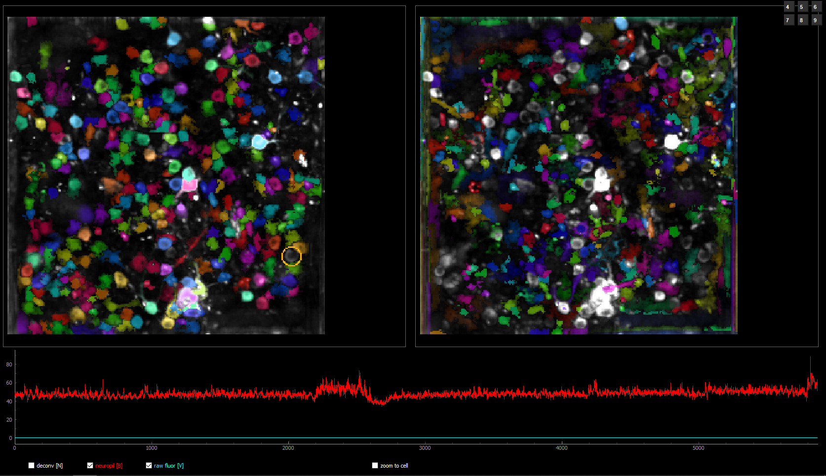 Extracted ROIs with constant F=0 · Issue #676 · MouseLand/suite2p · GitHub