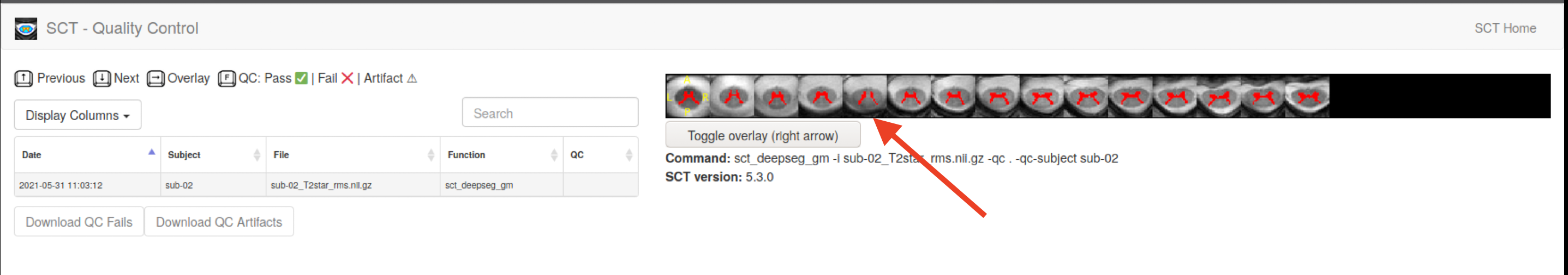 Discrepancy between QC output and real segmentation · Issue #3406 · spinalcordtoolbox ...