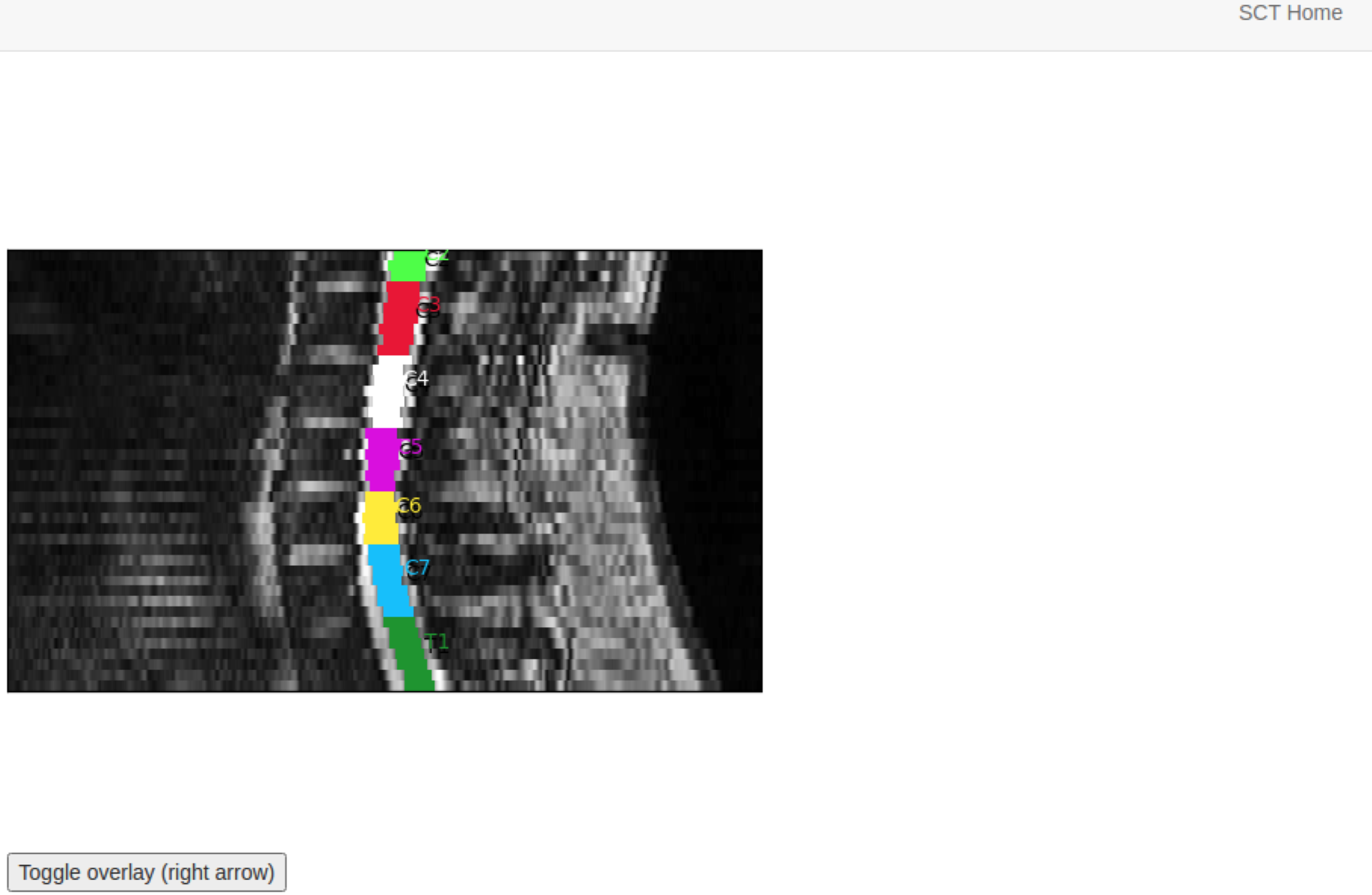 QC report for vertebral labeling is ridiculously small · Issue #3055 · spinalcordtoolbox ...