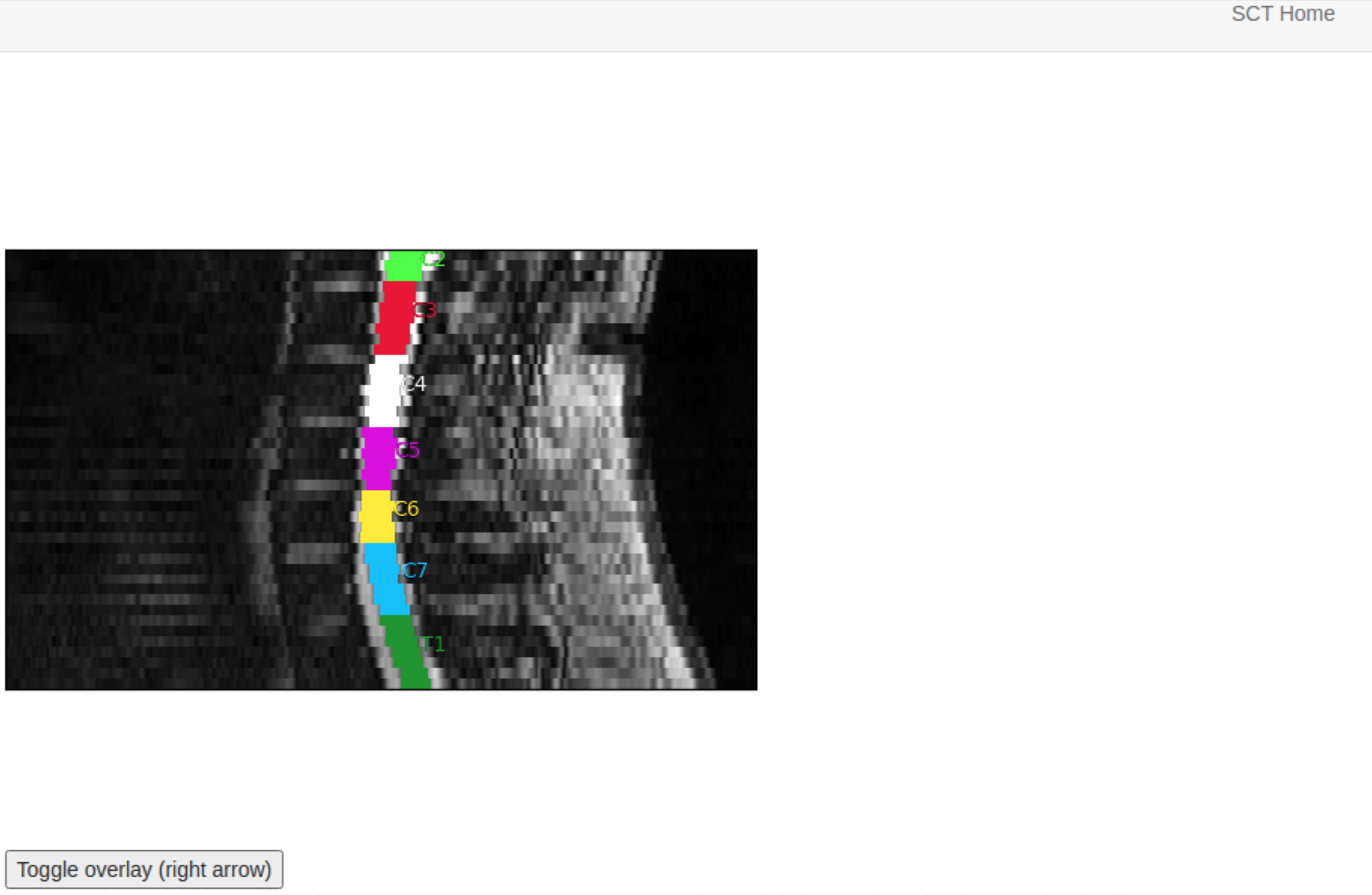 QC report for vertebral labeling is ridiculously small · Issue #3055 · spinalcordtoolbox ...