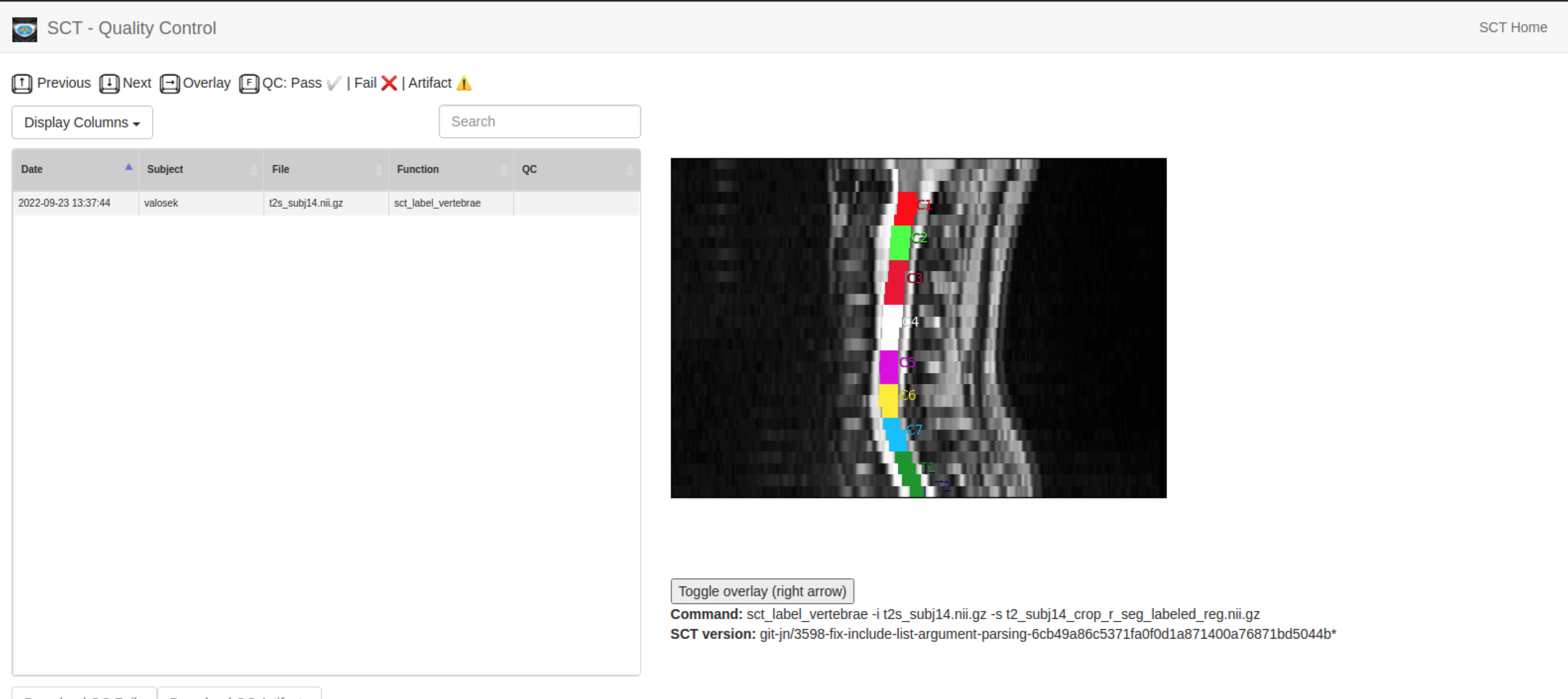 QC report for vertebral labeling is ridiculously small · Issue #3055 · spinalcordtoolbox ...