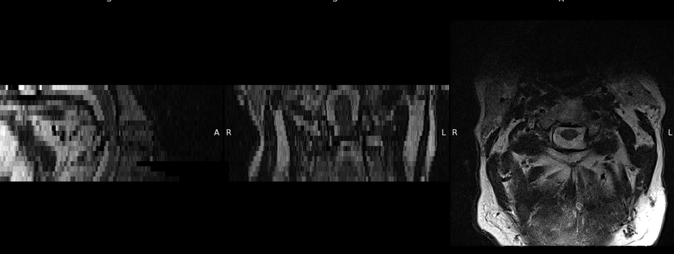 `sctimage Stitch` Qc Showing Empty Slice · Issue 4051 · Spinalcordtoolboxspinalcordtoolbox 