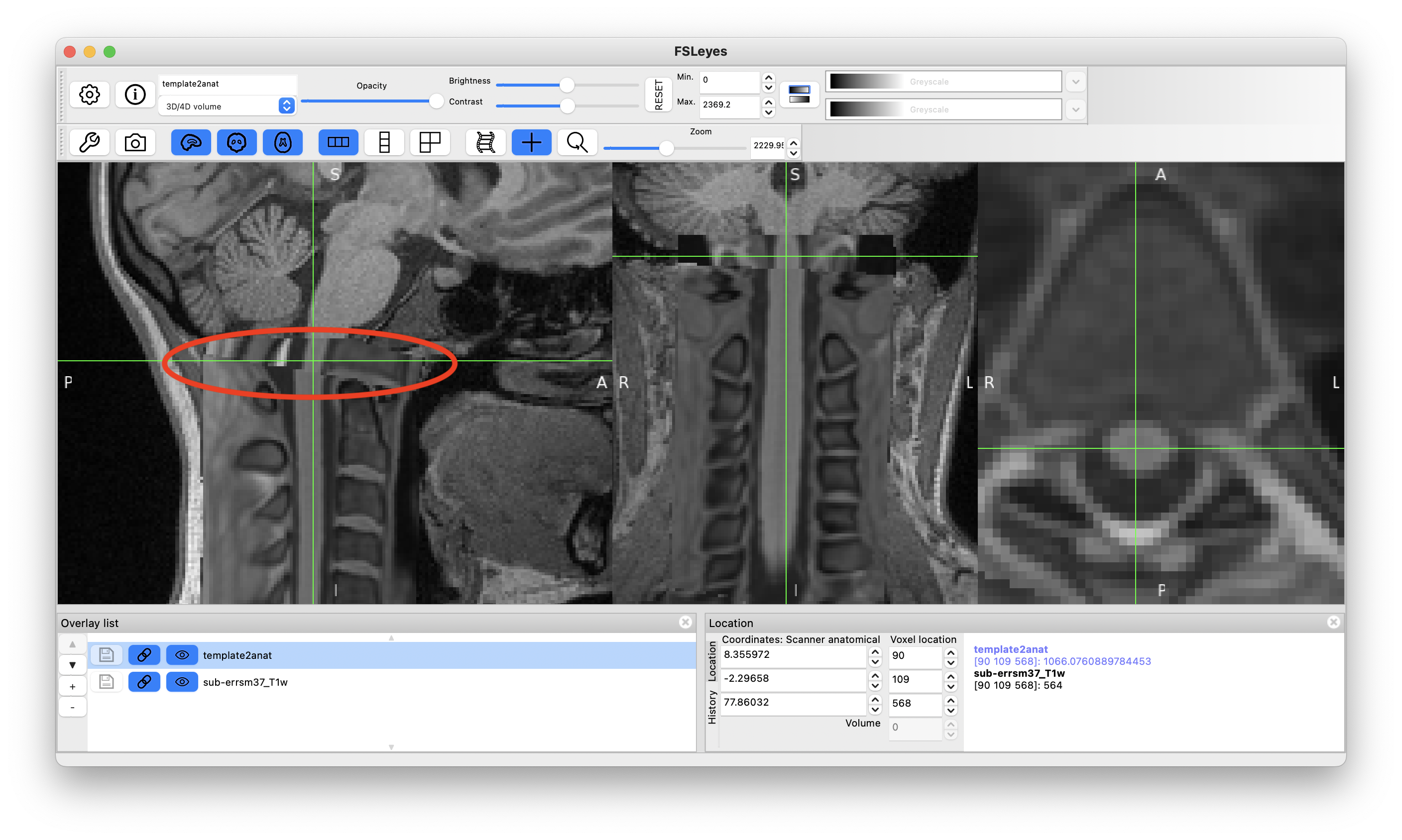 Registration using 3+ disc labels results in distorted top portion of warped template · Issue ...