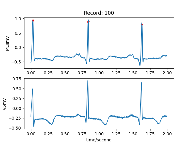 Plot Wfdb Times Don T Math For Annotation And Record · Issue 162 · Mit Lcp Wfdb Python · Github