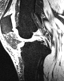 GitHub - brendan0403/BonesSegmentation: Bones segmentation by Deep Learning