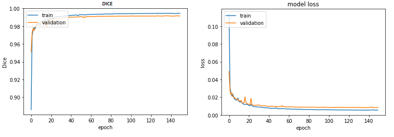 GitHub - brendan0403/BonesSegmentation: Bones segmentation by Deep Learning
