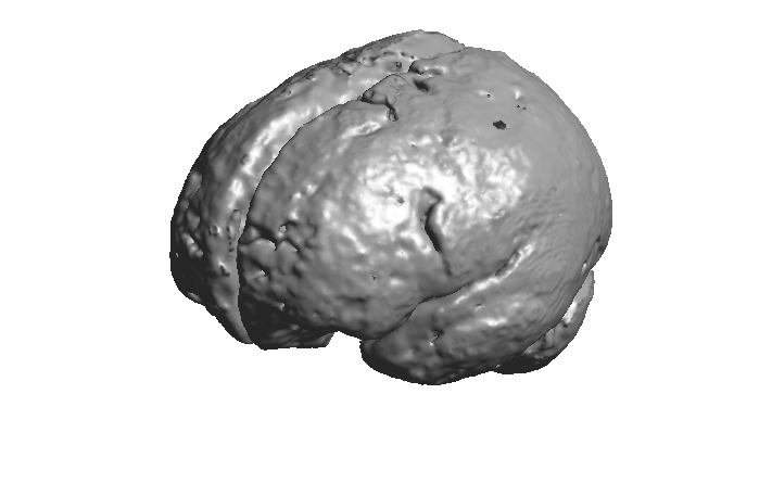 Charm Segmentation Issues in Simnibs · simnibs simnibs · Discussion ...