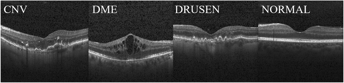 GitHub - YogeshSai/retinal-diseases-detection-and-classification