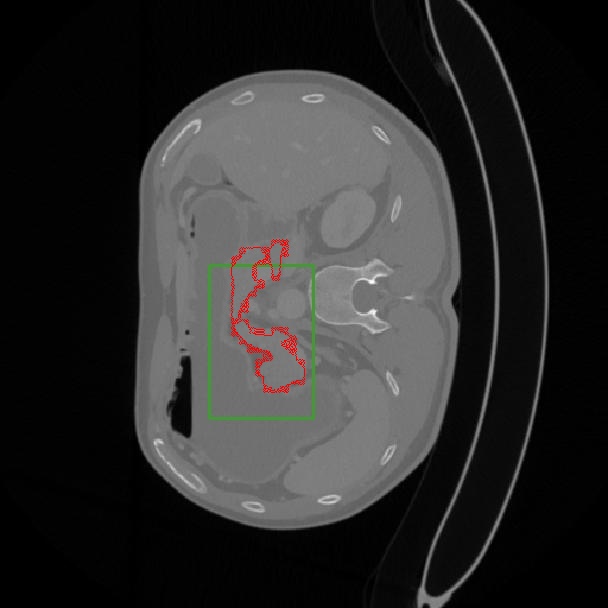IOU error (#422) · Issues · Ultralytics / YOLOv3 · GitLab