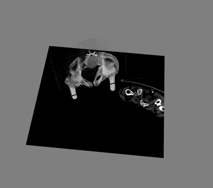 Code Logic Error In Imagereslicejs · Issue 2714 · Kitwarevtk Js · Github 5046