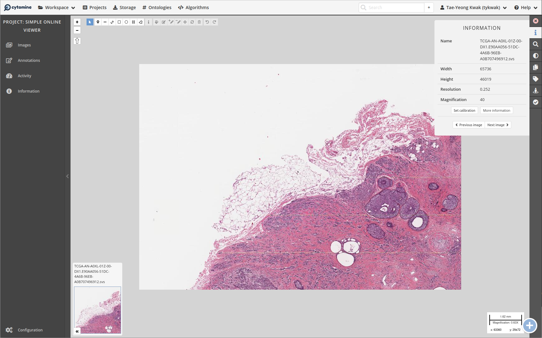 Image Processing Failure · Issue #36 · cytomine/Cytomine-IMS · GitHub