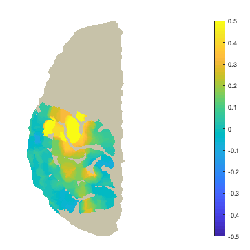 pos2transform in ft_sourceplot fails for iEEG data · Issue #1385 · fieldtrip/fieldtrip · GitHub