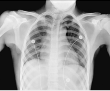 GitHub - strawhat98/Edge_detection_algorithm: Implementation of Edge ...