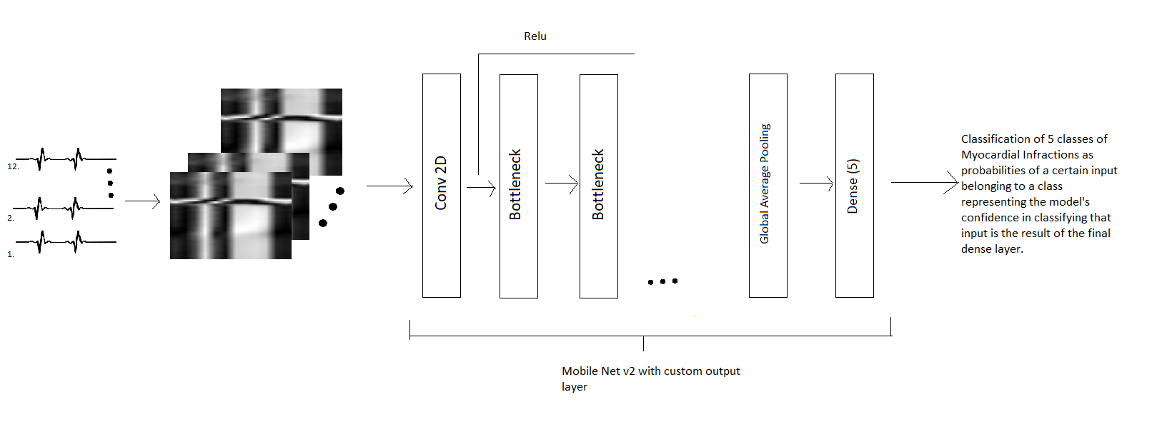 GitHub - PushBI/ECG-Transfer-Learning-Using-MobileNetV2