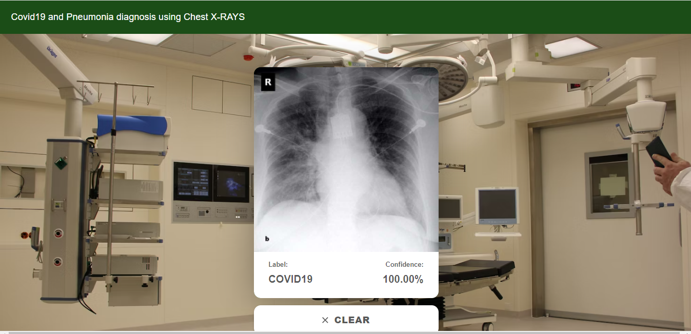 GitHub - guddushah/Covid19-Pneumonia-diagnosis-using-chest-XRays-Deep ...