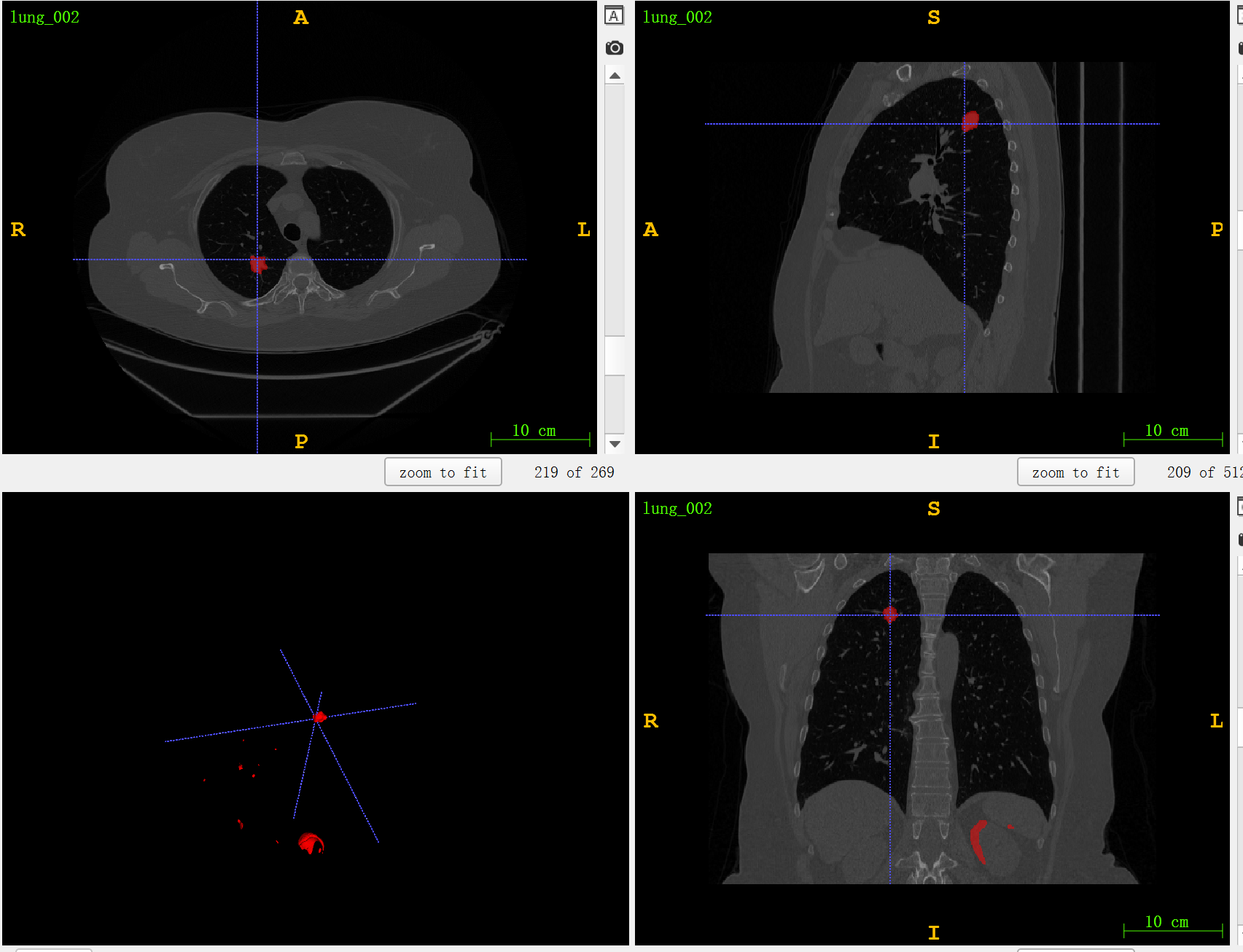 nnunet模型精度问题 · Issue #3334 · PaddlePaddle/PaddleSeg · GitHub