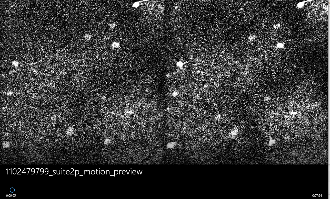 Investigate Suite2P motion correction module for source of erroneous ...