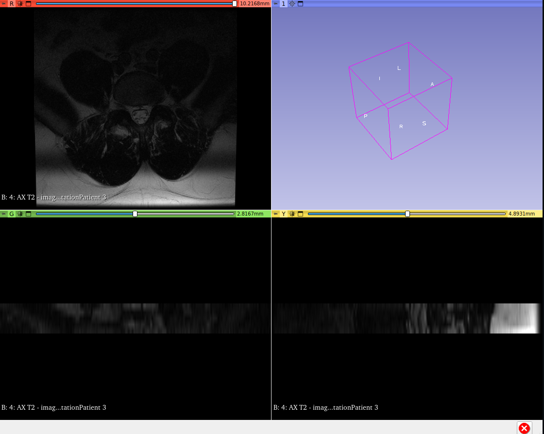 DICOM previews are stretched · Issue #6560 · Slicer/Slicer · GitHub