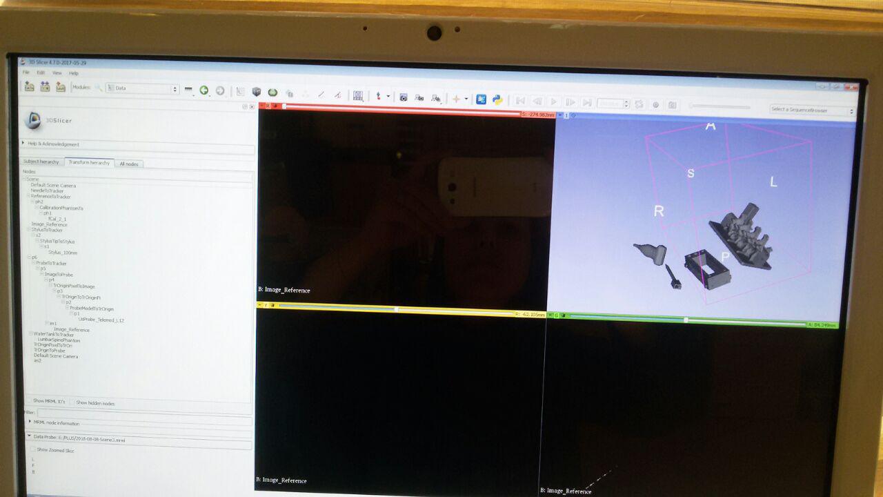 Problem with creating the Scene · Issue #399 · PlusToolkit/PlusLib · GitHub
