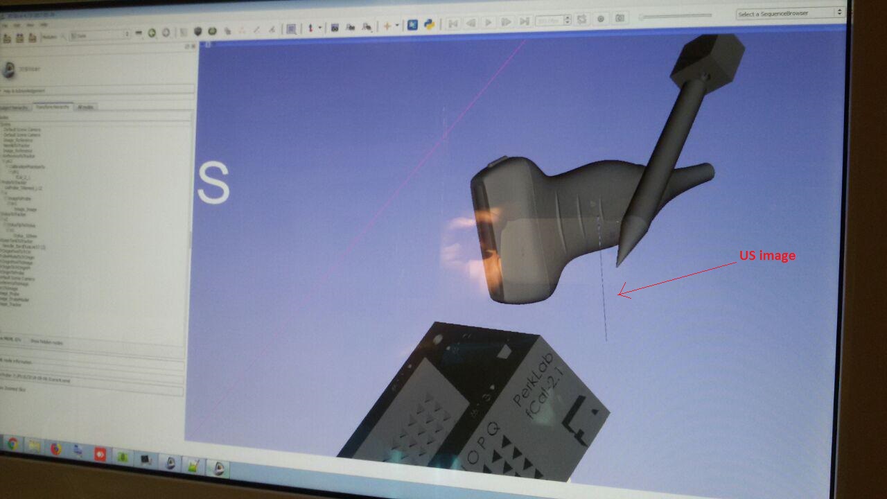 Problem with creating the Scene · Issue #399 · PlusToolkit/PlusLib · GitHub