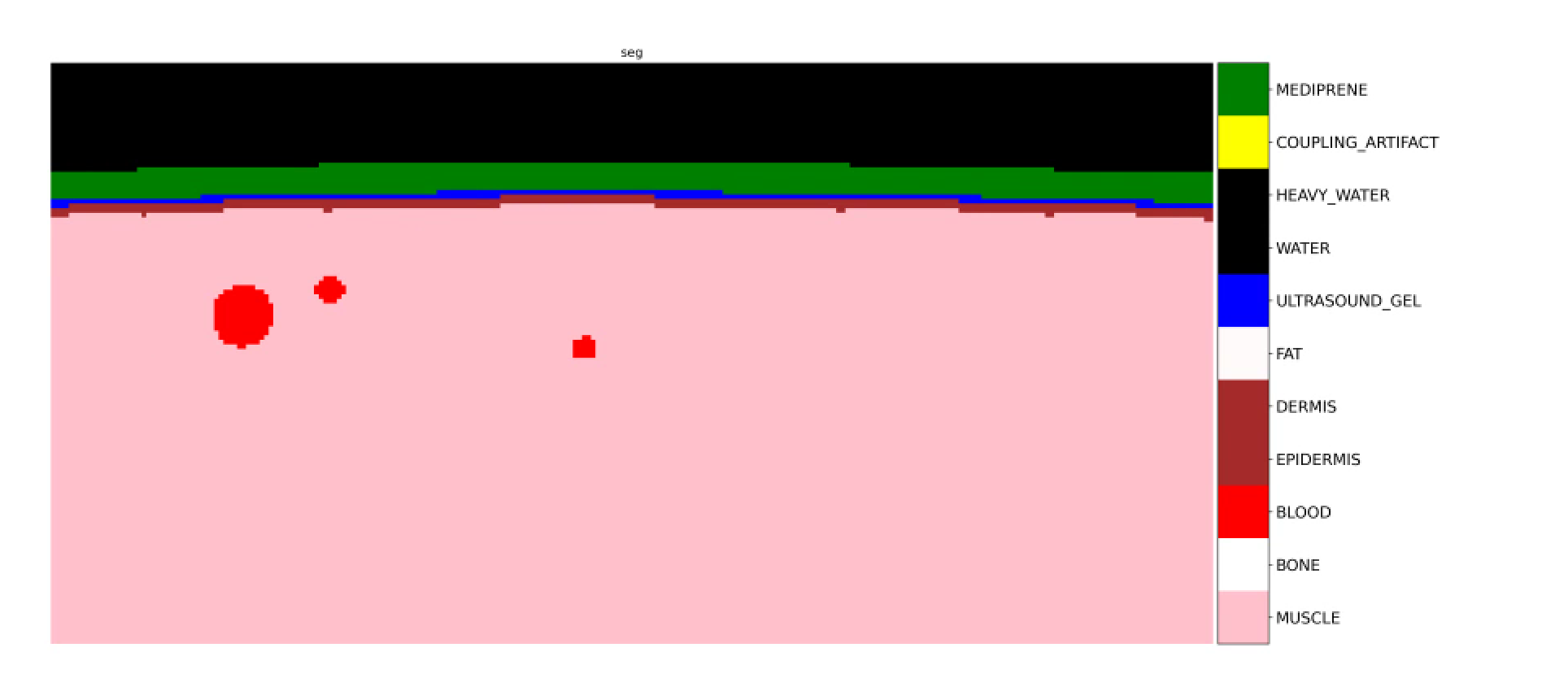 Segmentation errors · Issue #109 · IMSY-DKFZ/simpa · GitHub