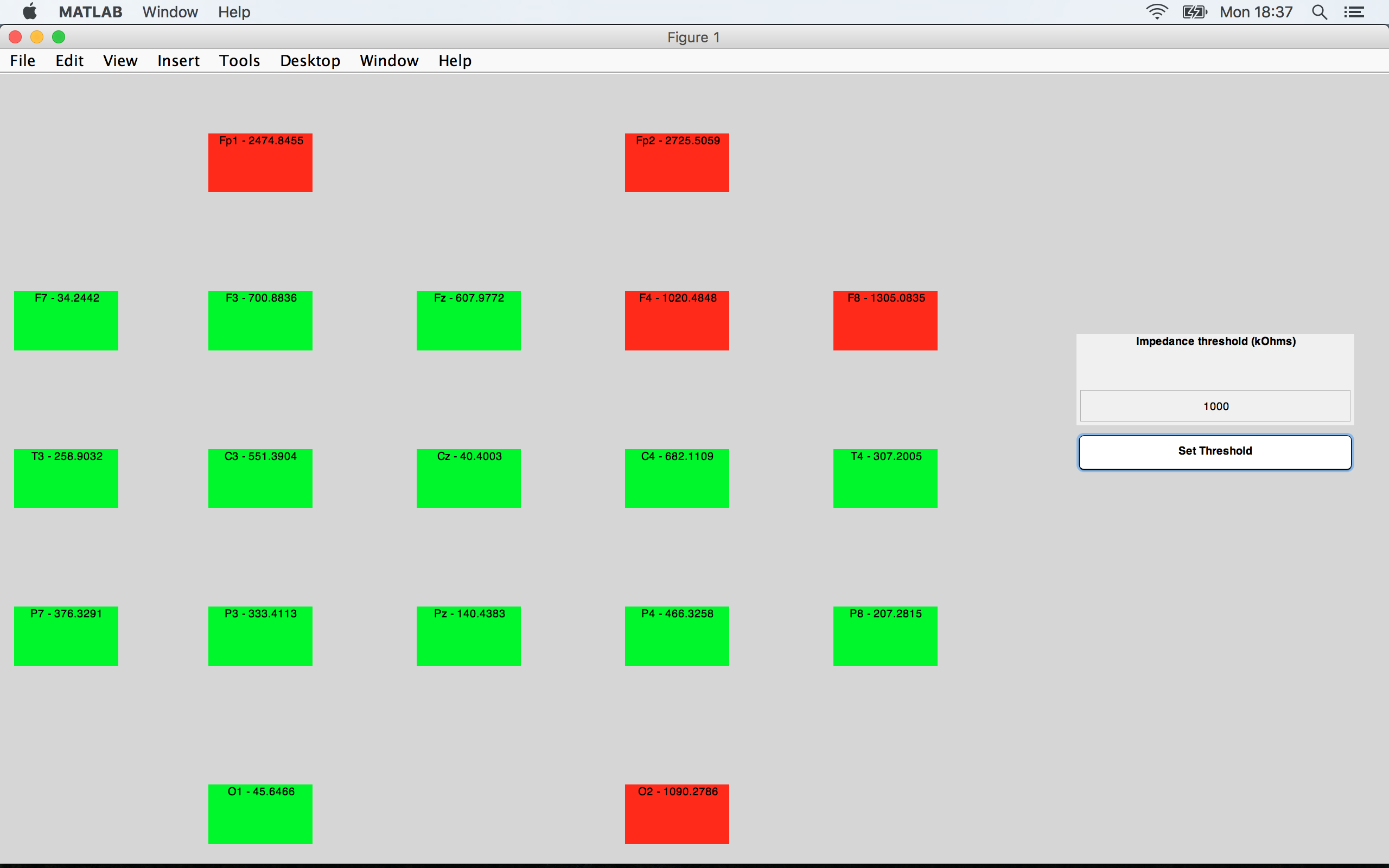 GitHub - joaoaraujo1/CognionicsQuick20-eeg-plot: Code that allows efficient reading, plotting ...