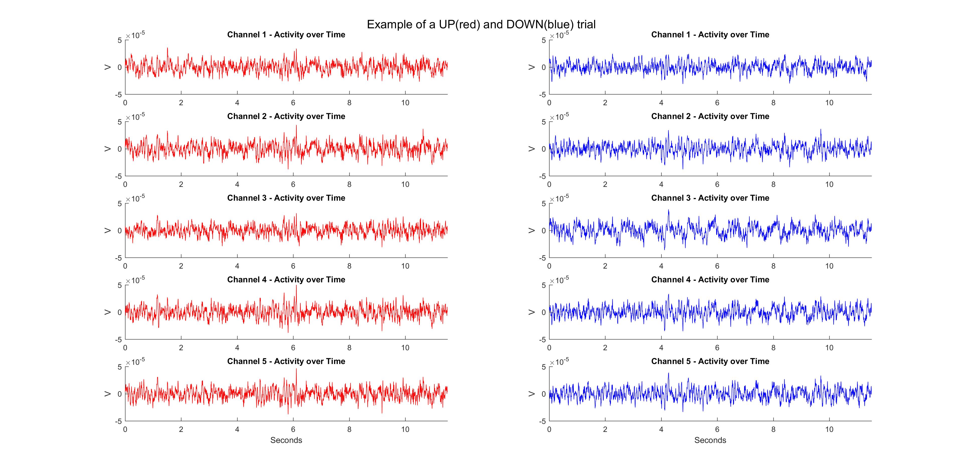 GitHub - joaoaraujo1/ML-BCI-dryEEG: Code and guide through my customizable machine-learning ...