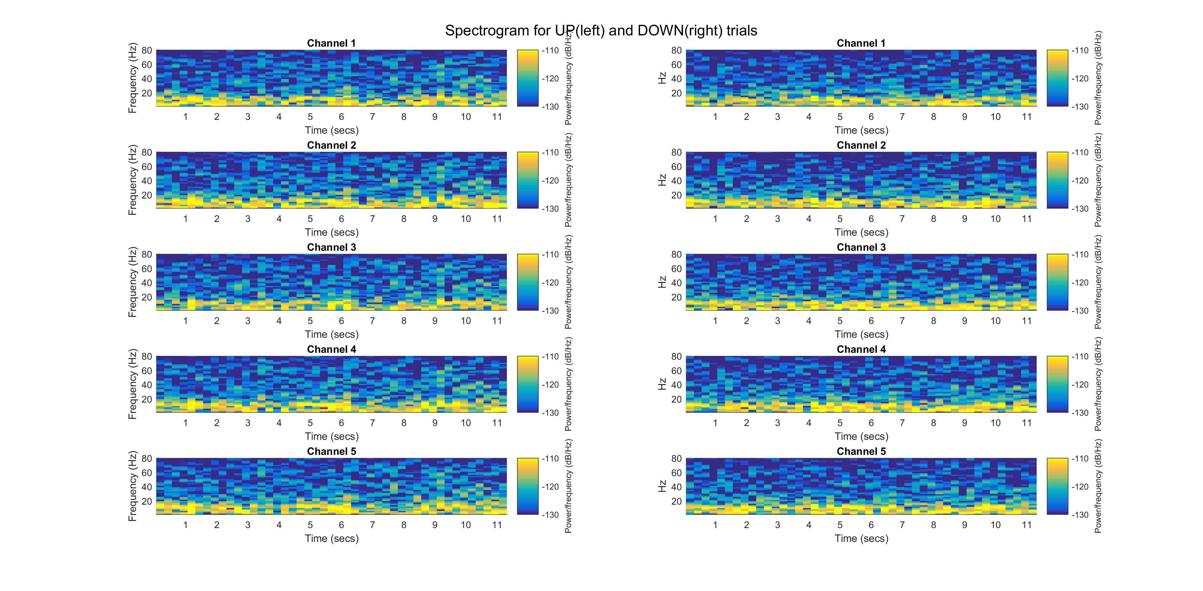 GitHub - joaoaraujo1/ML-BCI-dryEEG: Code and guide through my customizable machine-learning ...