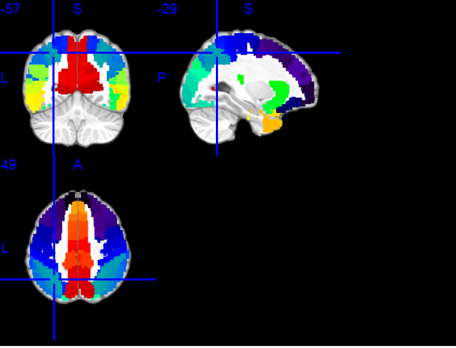 Brain atlases not registering correctly to the MNI brain or T1w brain ...