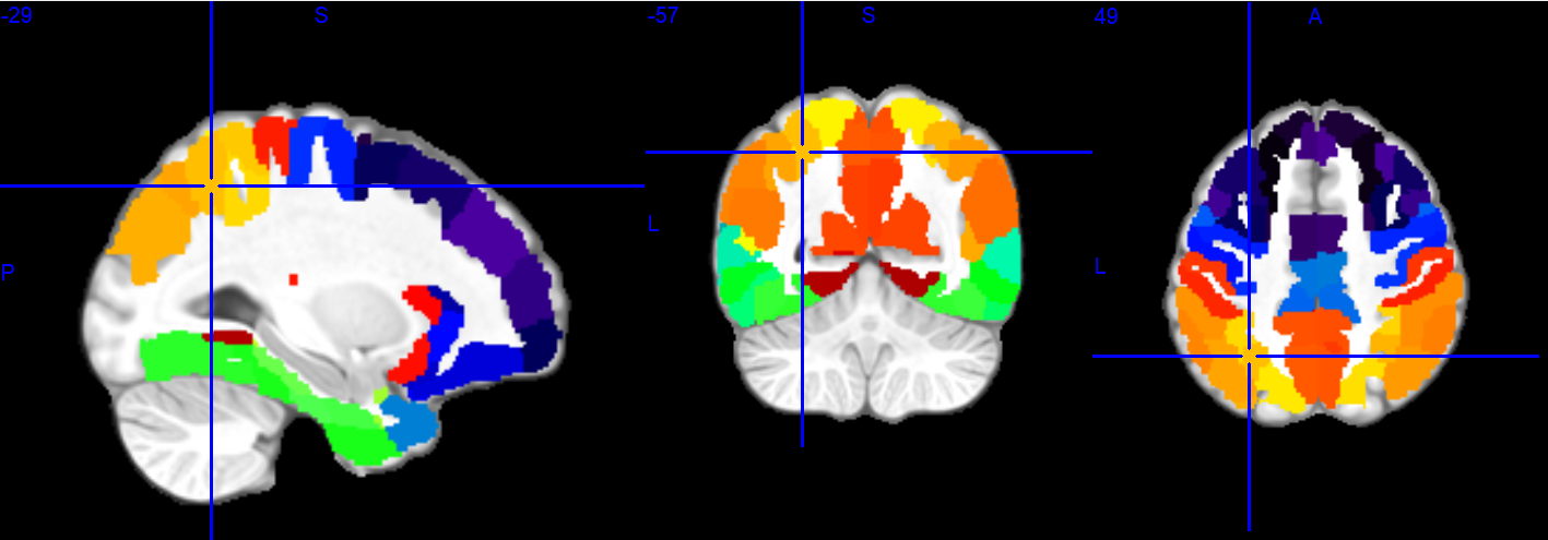 Brain atlases not registering correctly to the MNI brain or T1w brain ...